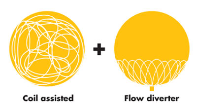 Neqstent™ Coil Assisted Flow Diverter | Stryker